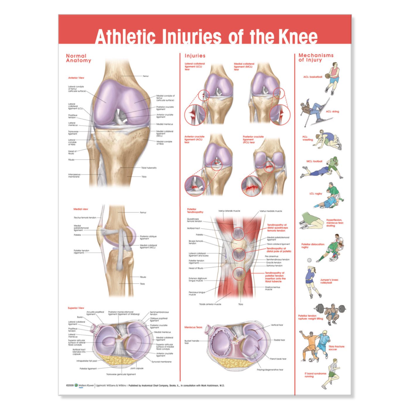 Athletic Injuries of the Knee Chart | Performance Health