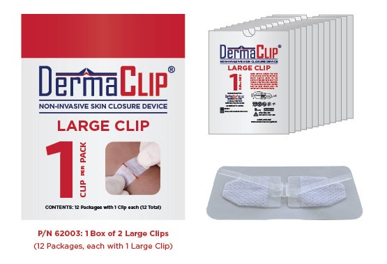 Effective and innovative needle-free closure device | Performance Health