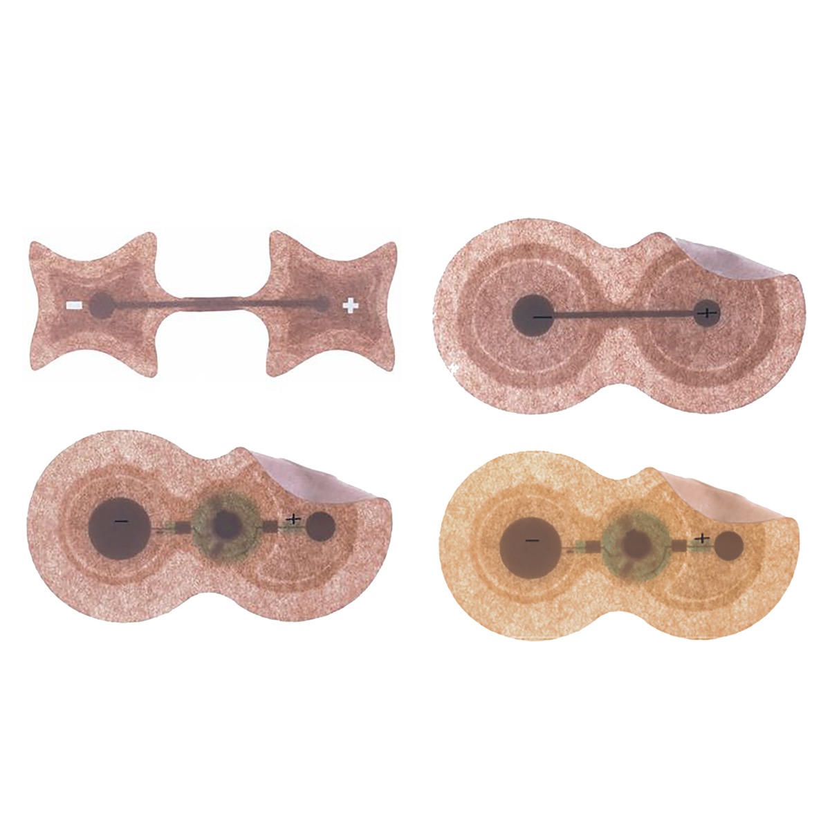 IontoPatch Iontophoresis Patches: A Drug-Free Solution for Pain ...