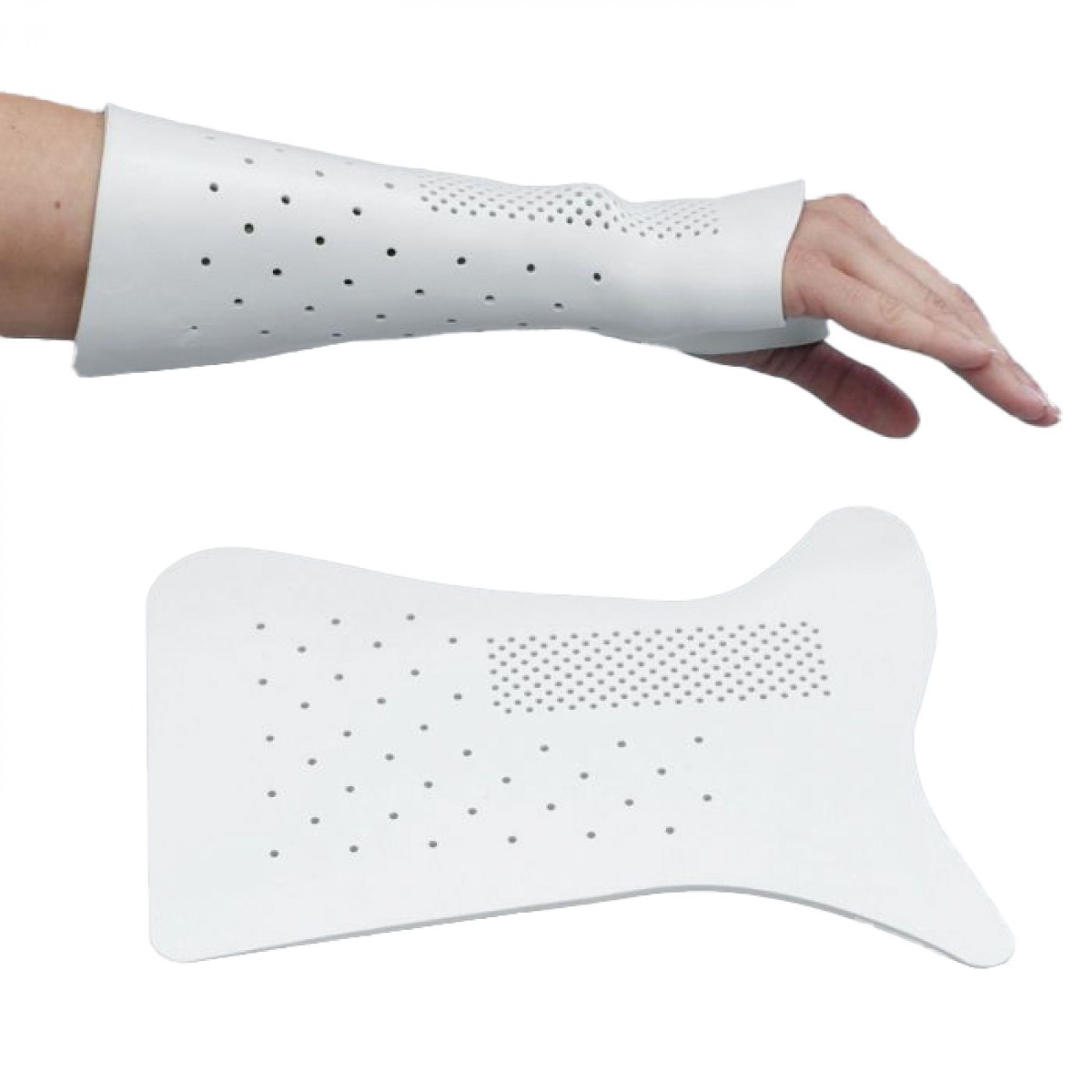 Ulnar Gutter Splint