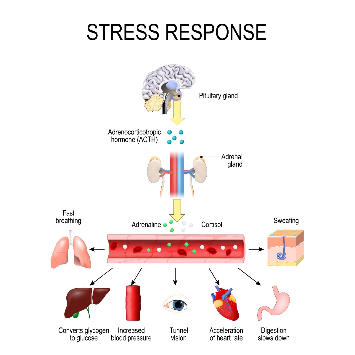 What Is Stress Causes Symptoms How It Affects Your Life What Is Stress Causes Symptoms How It Affects Your Life